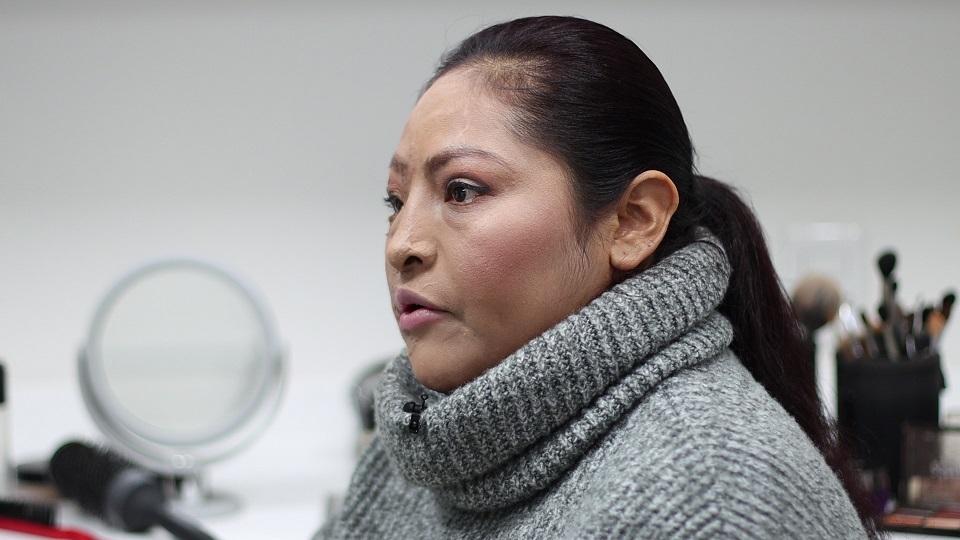 Retomar la vida tras un ataque con ácido, el largo y difícil proceso ...